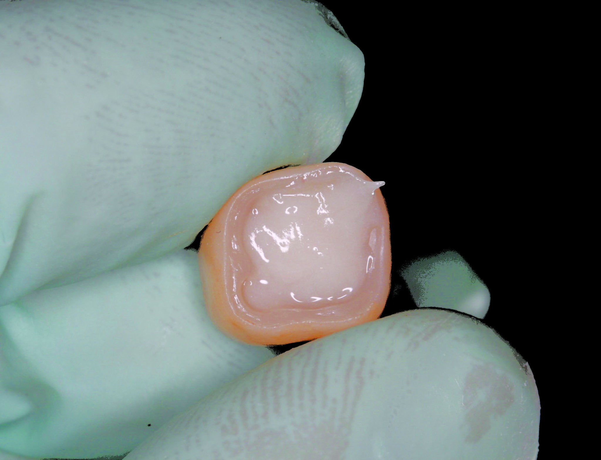 Self-Adhesive Resin - ZR-Cem™ - Burkhart Dental Supply