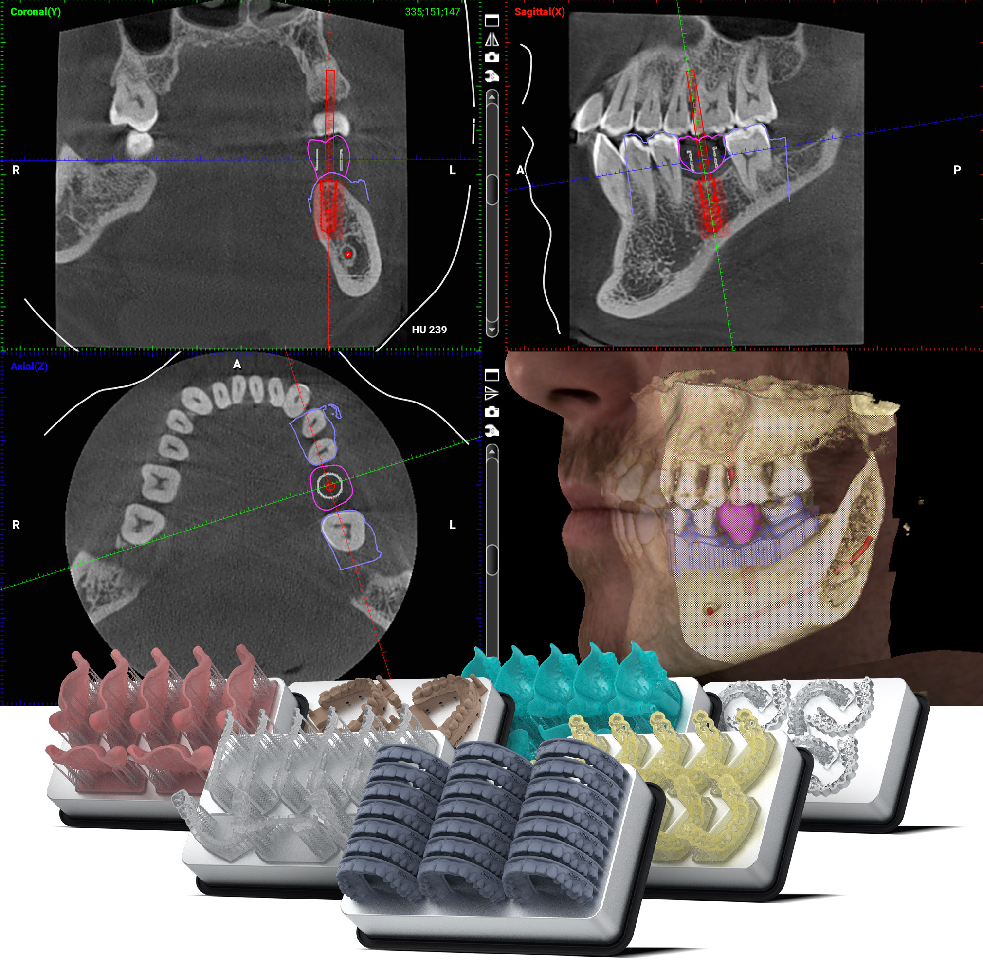 Technology Solutions for Today’s Dental Practice Challenges - Burkhart ...